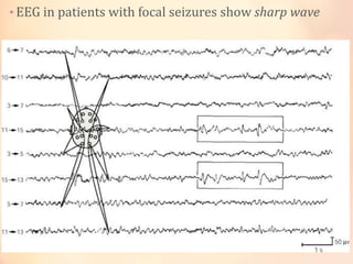 Evoked potentials, clinical importance & physiological basis of consciousness, eeg changes in ...