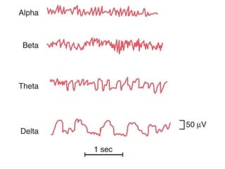 Evoked potentials, clinical importance & physiological basis of consciousness, eeg changes in ...