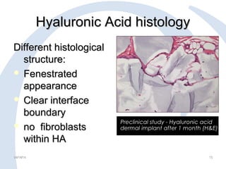 Evolence Dermal Filler | PPT