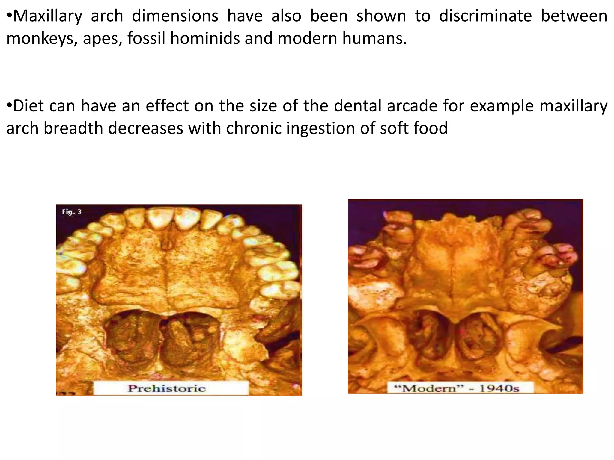 Evolution of jaws and tmj | PPTX