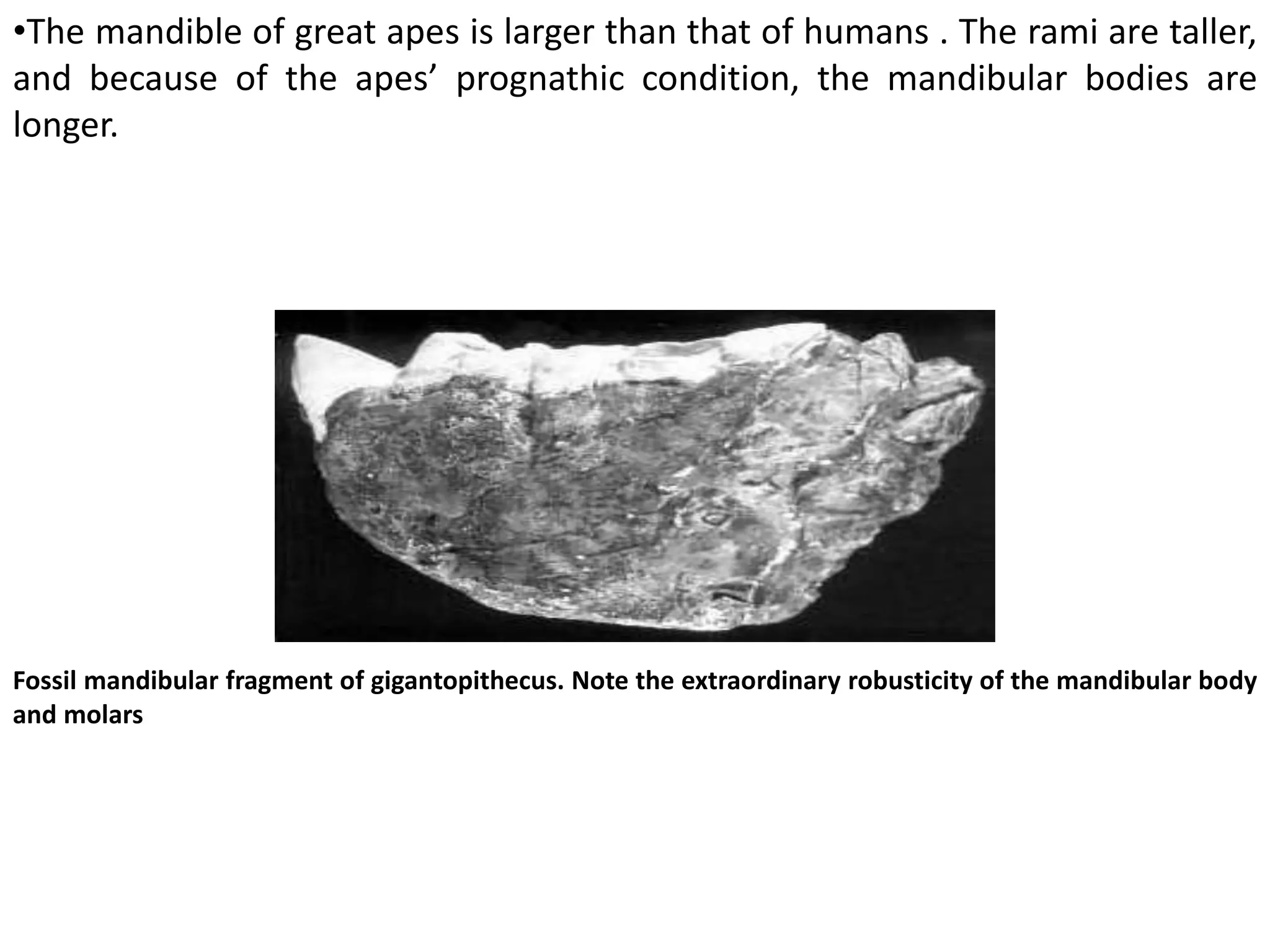 Evolution of jaws and tmj | PPTX