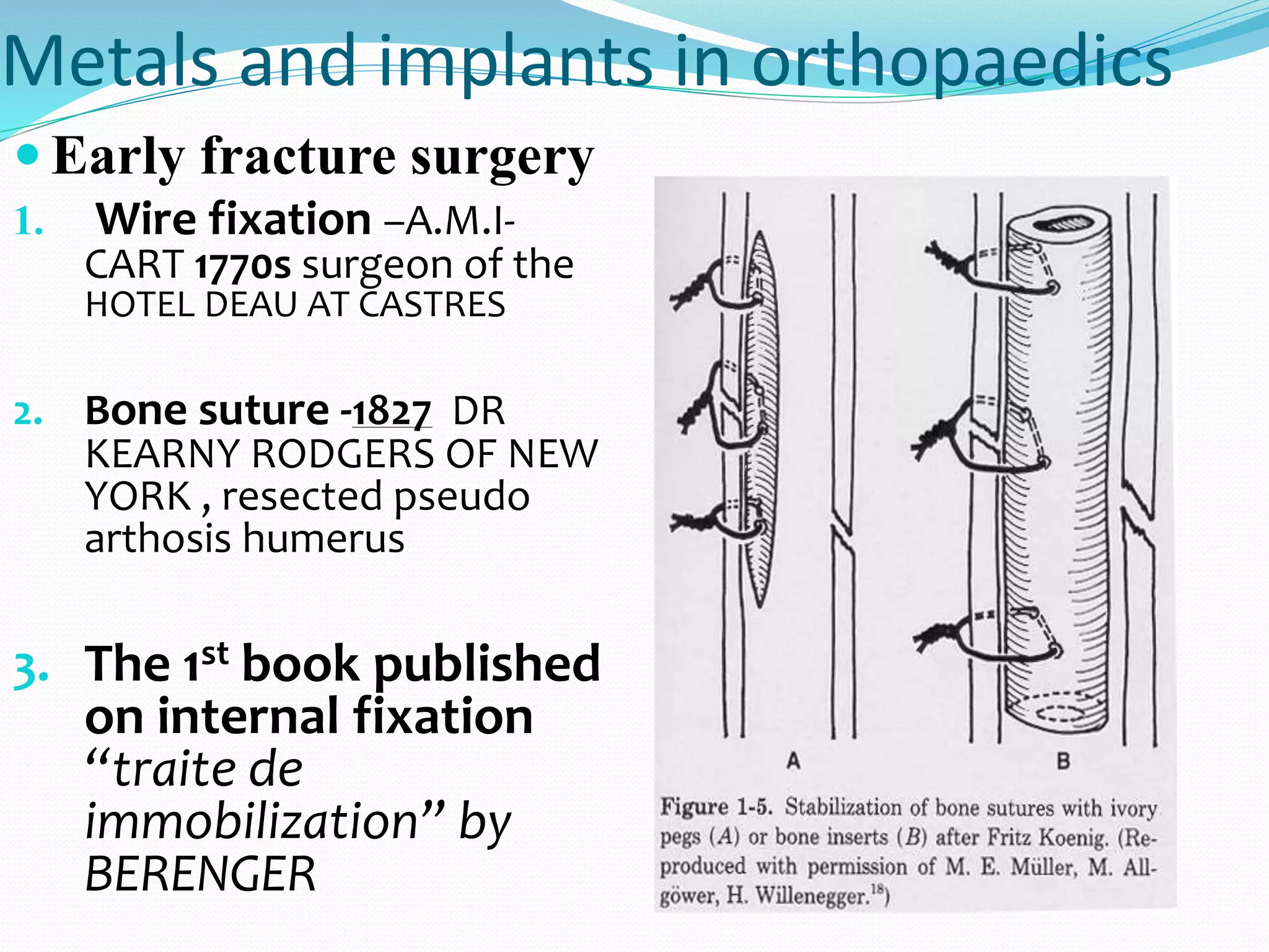 Evolution and generation of orthopaedic implants | PPTX