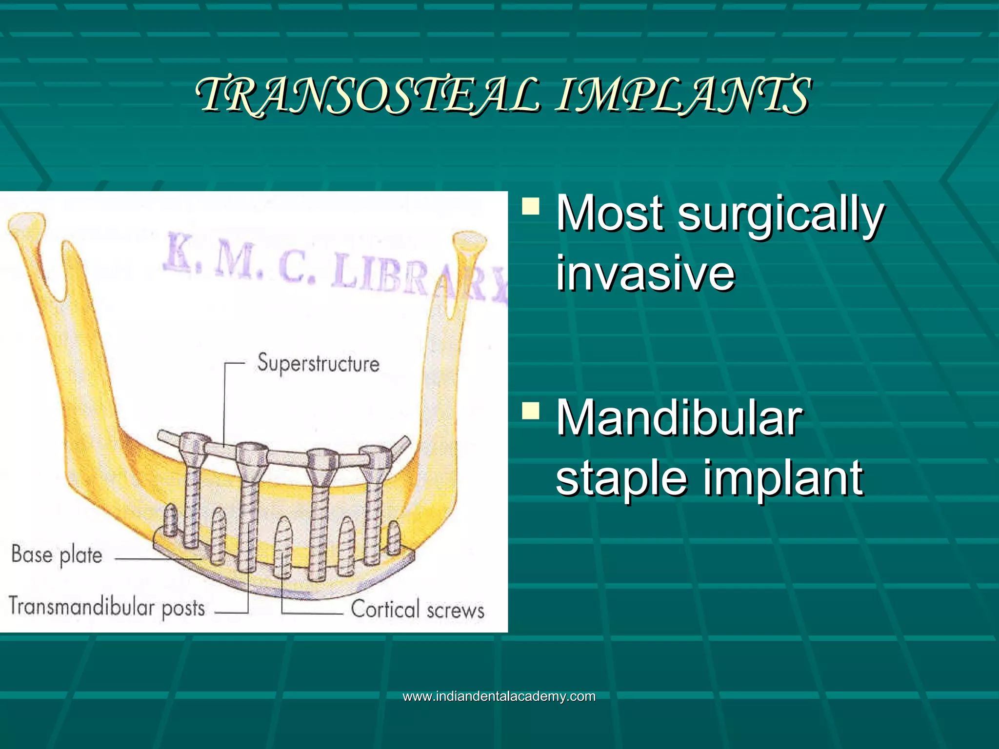 Evolution classification and components of implants/ orthodontic ...