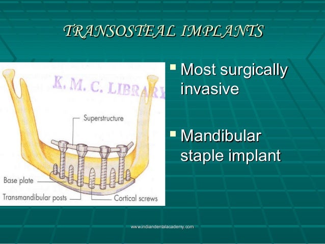 Evolution classification and components of implants/ orthodontic ther…