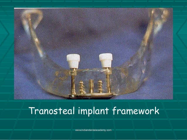 Evolution classification and components of implants/ orthodontic ther…