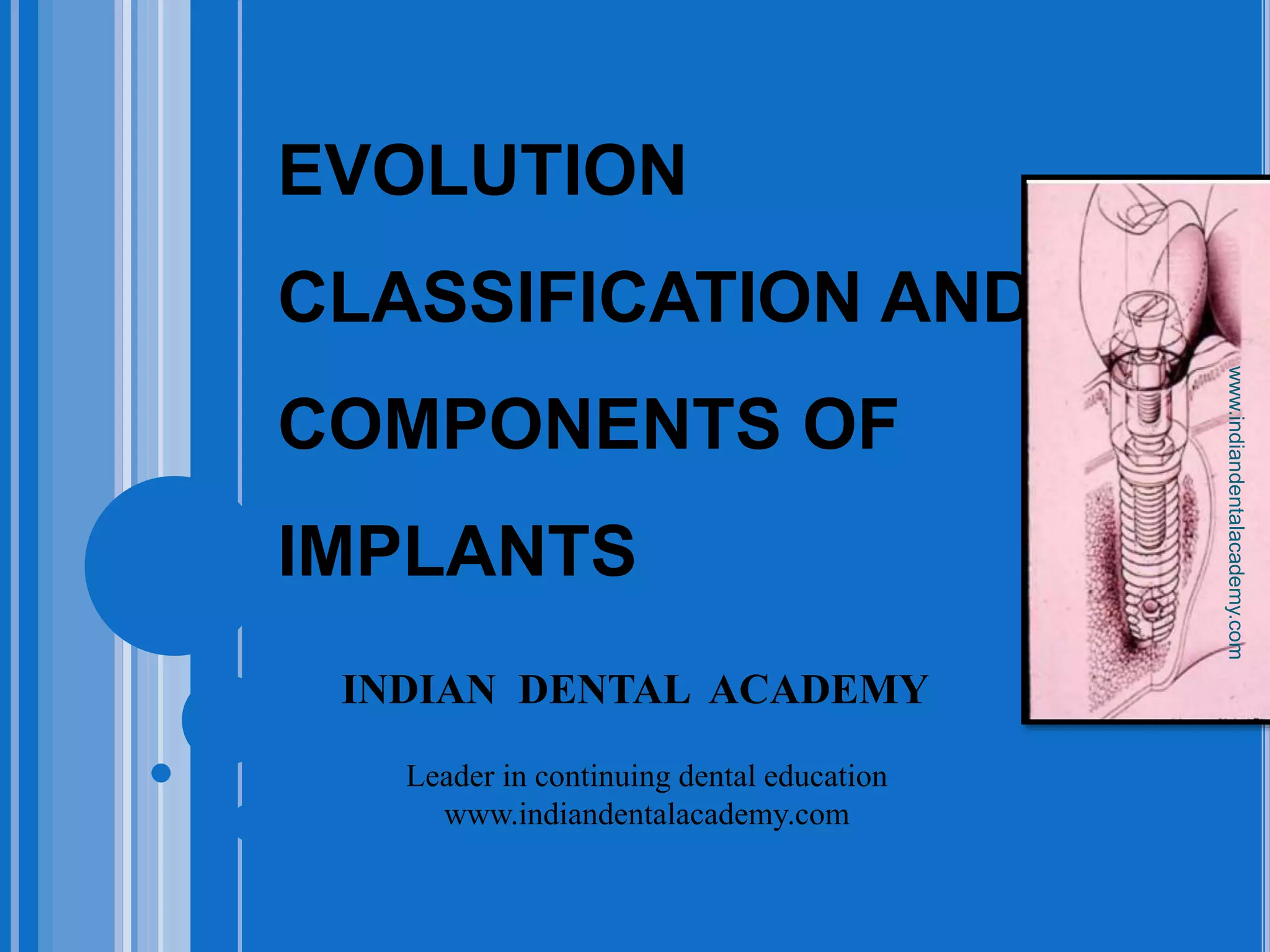 Evolution ,components and classification of implants/ orthodontic ...