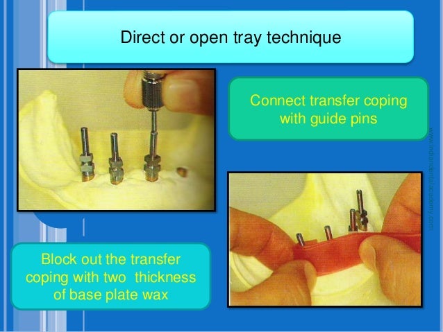 Evolution ,components and classification of implants/ orthodontic pra…