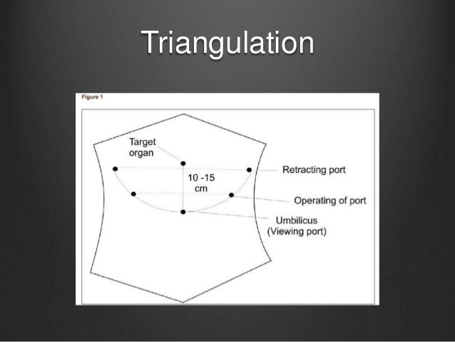 Evolution & Ergonomics in Laparoscopy