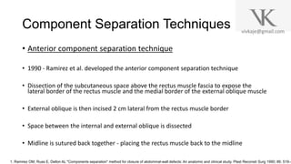 Evolution of Ventral Hernia Repair | PPTX