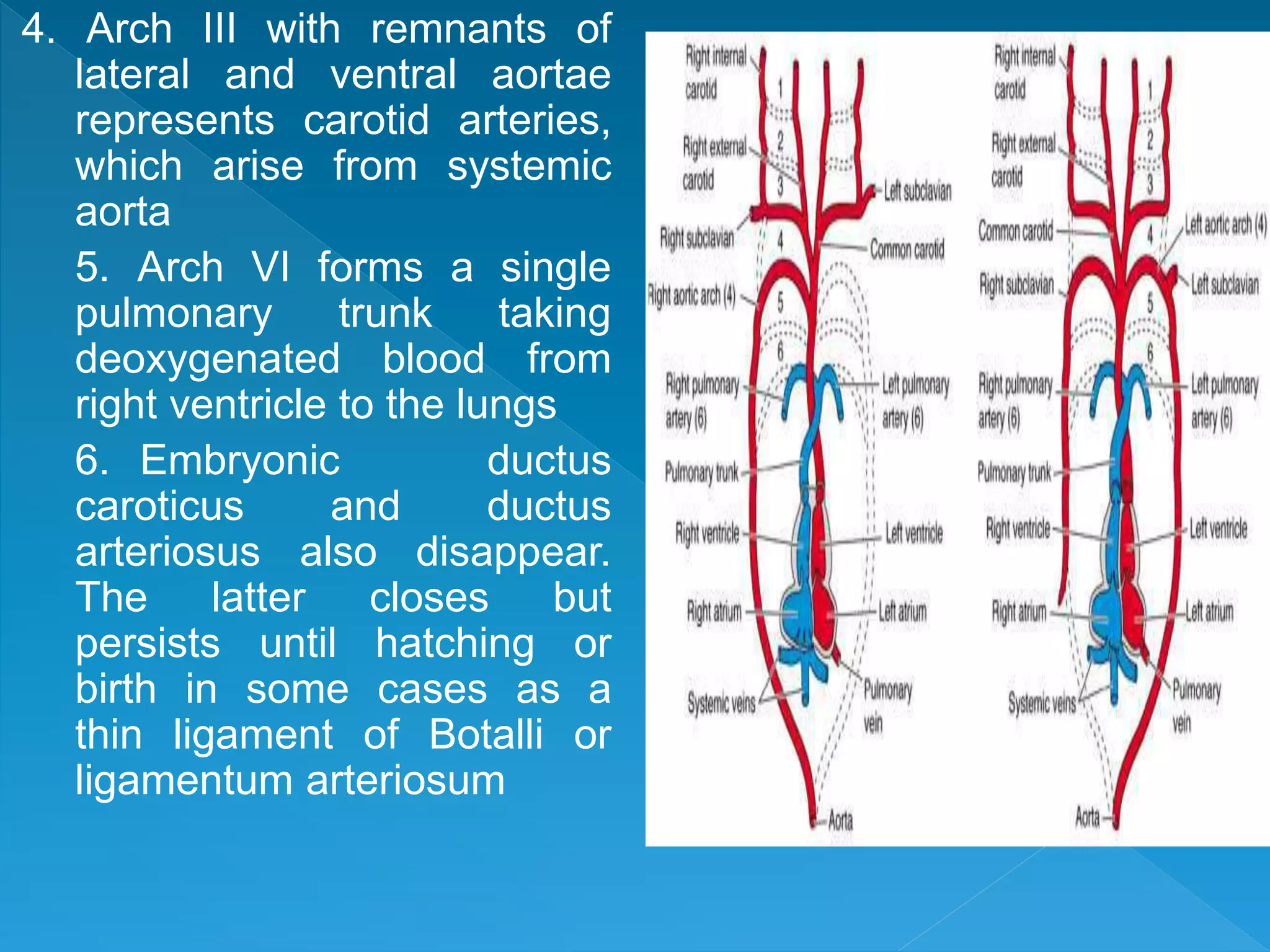 Evolution of arotic arches.pptx