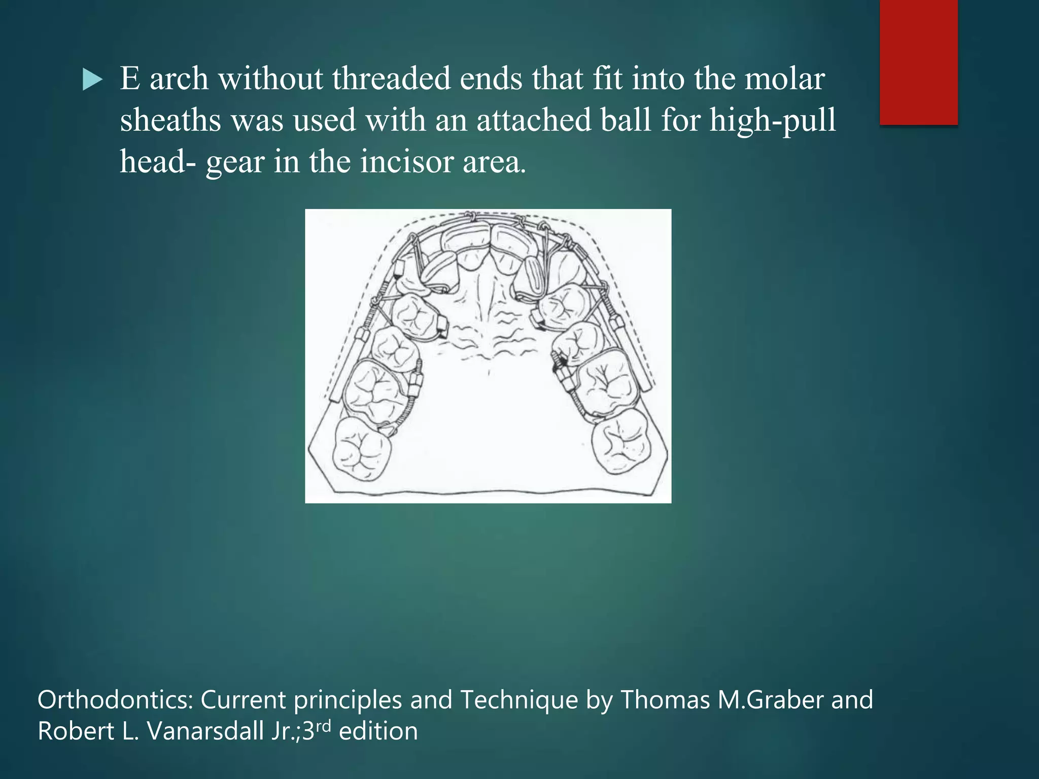 Evolution of brackets | PPTX