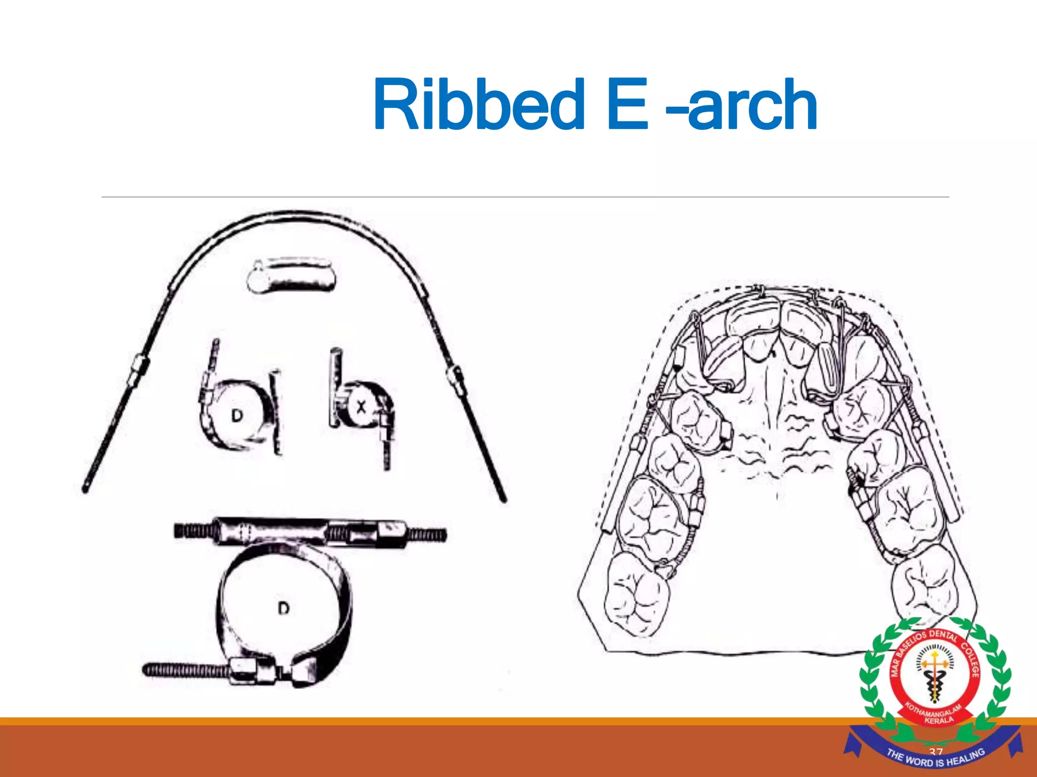 EVOLUTION OF BRACKETS.ppt