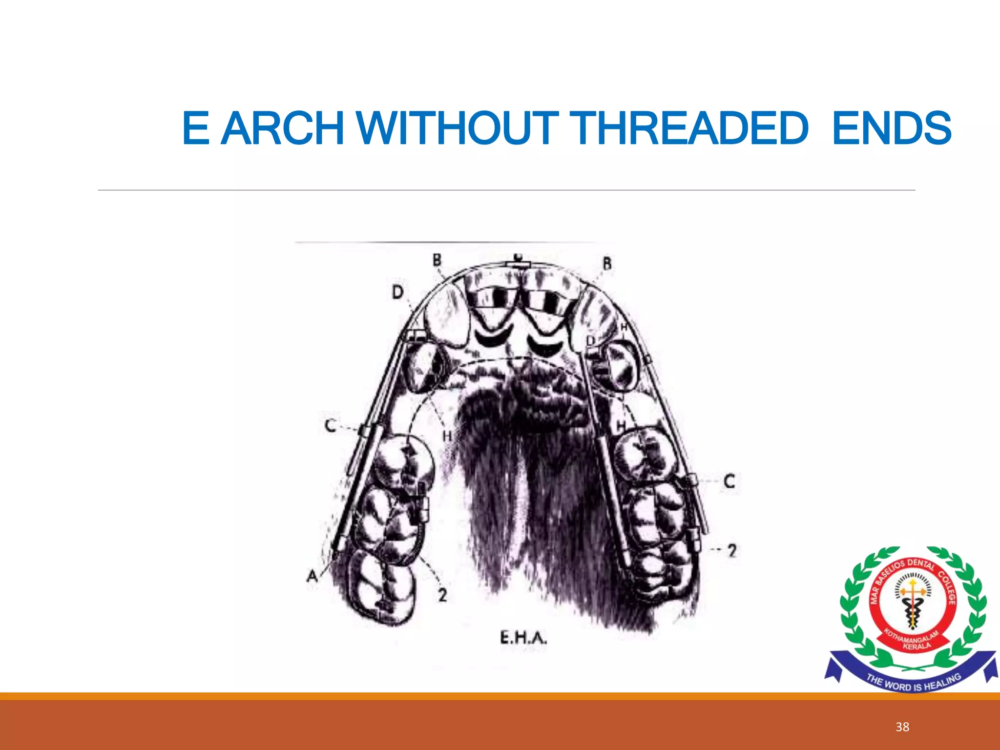 EVOLUTION OF BRACKETS.ppt