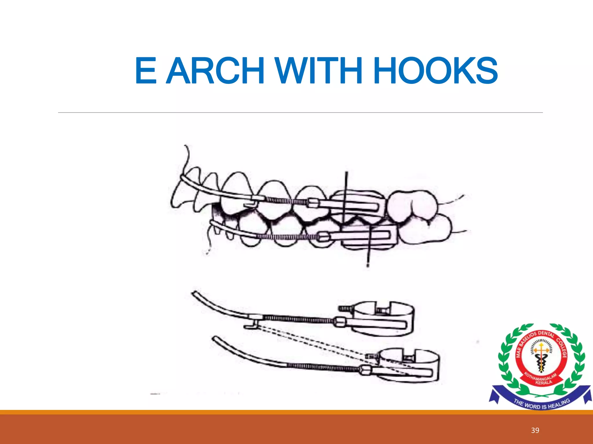 EVOLUTION OF BRACKETS.ppt