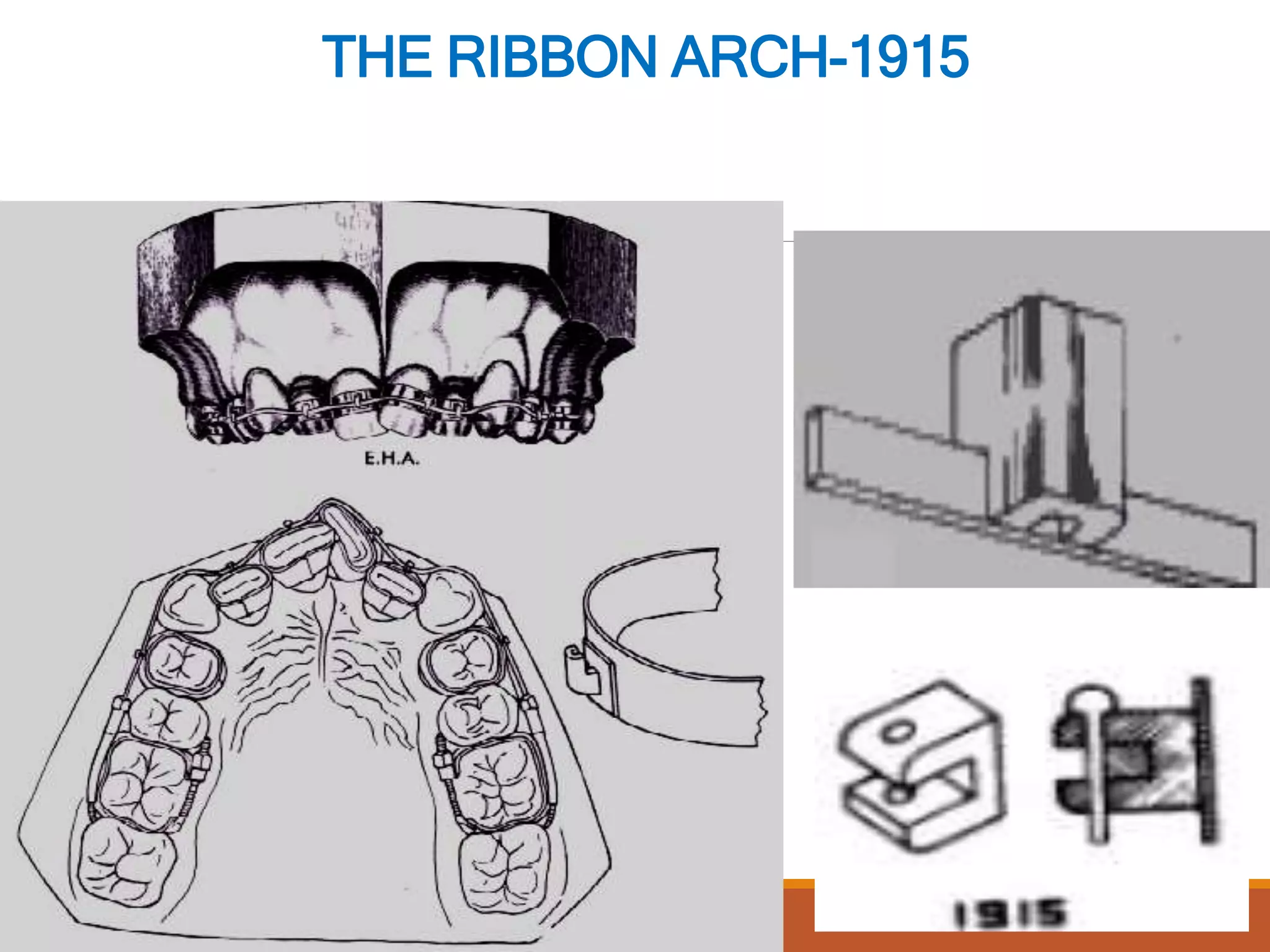 EVOLUTION OF BRACKETS.ppt