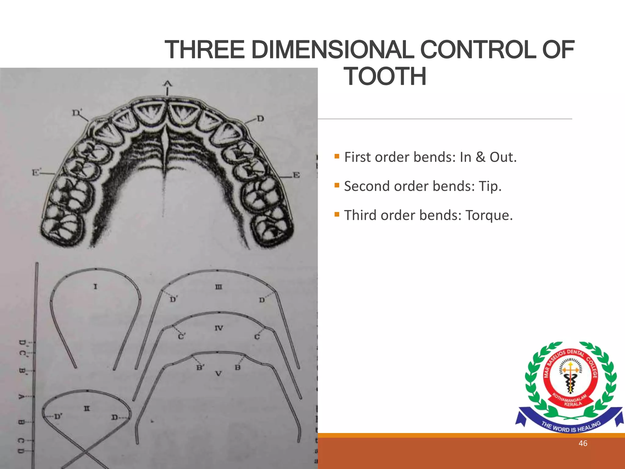 EVOLUTION OF BRACKETS.ppt