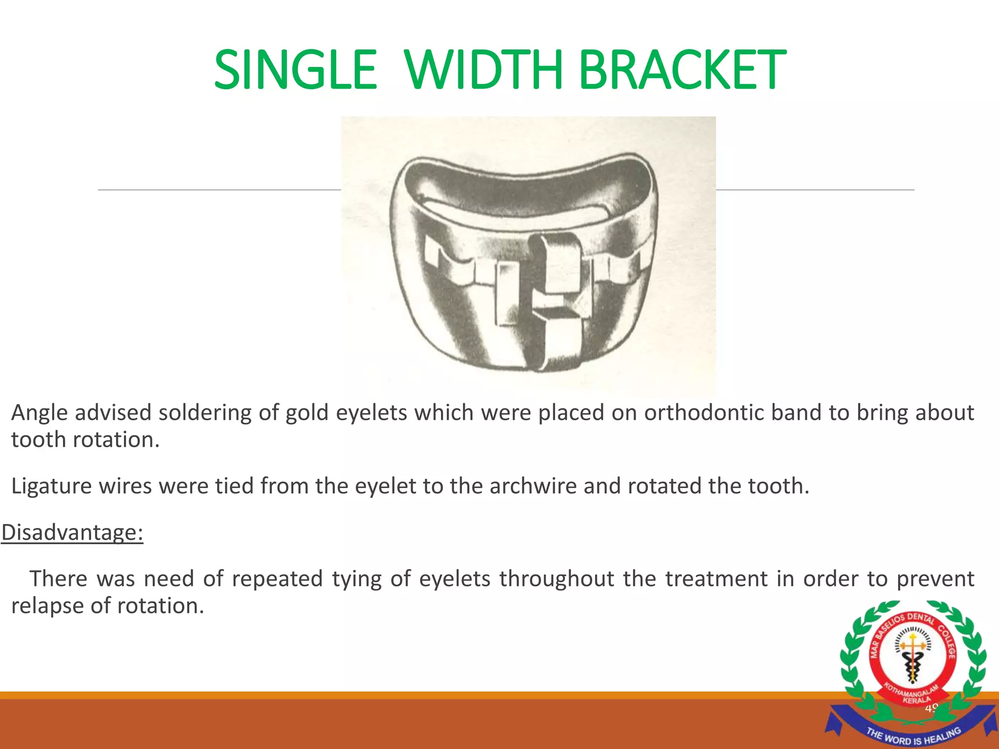 EVOLUTION OF BRACKETS.ppt