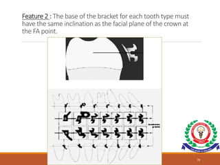 EVOLUTION OF BRACKETS.ppt