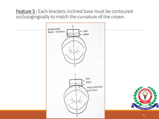 EVOLUTION OF BRACKETS.ppt