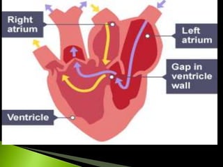 Evolution of heart by qudratullah | PPTX