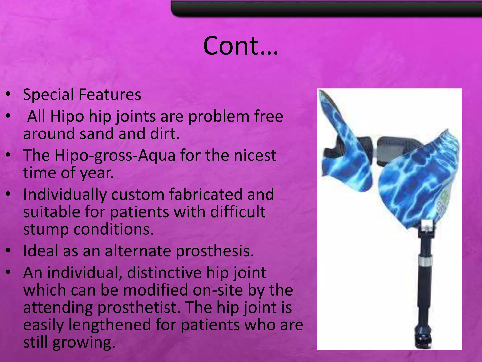 Evolution of hip disarticulation prosthesis | PPTX