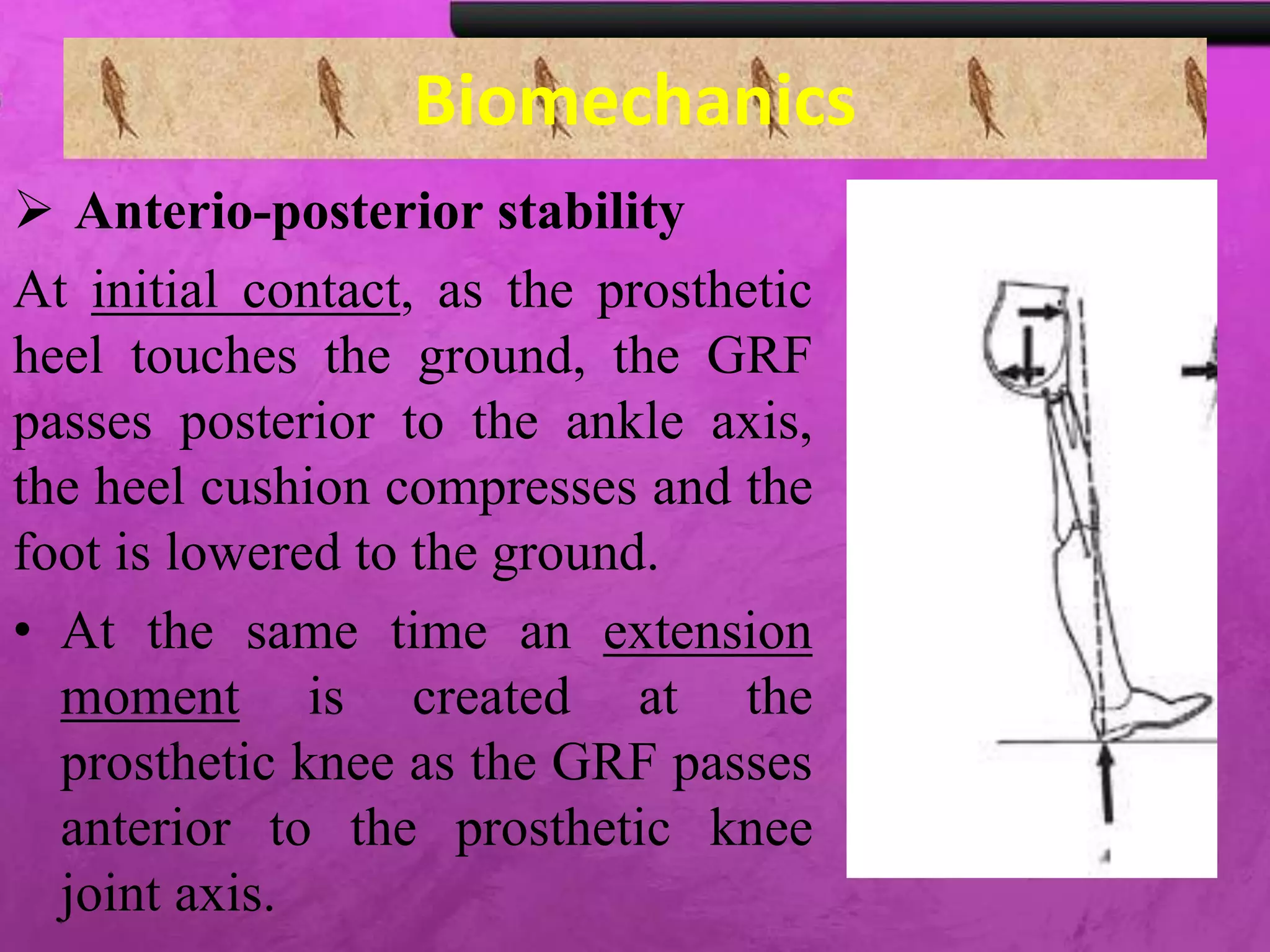 Evolution of hip disarticulation prosthesis | PPTX