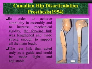 Evolution of hip disarticulation prosthesis | PPTX