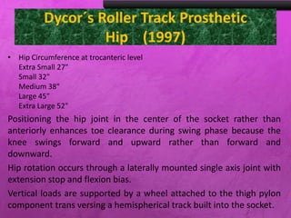 Evolution of hip disarticulation prosthesis | PPTX