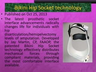Evolution of hip disarticulation prosthesis | PPTX