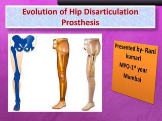 Bilateral Hip Disarticulation