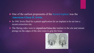 Evolution of implant designs, Dr Justin Ninan | PPTX