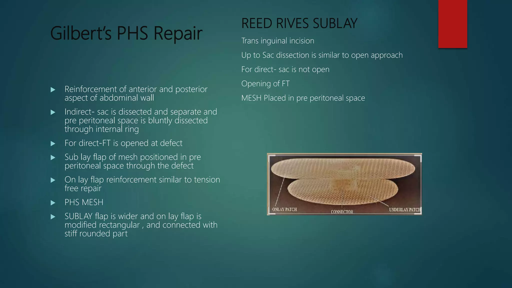 Evolution of inguinal hernia repair | PPTX
