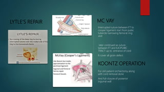 Evolution of inguinal hernia repair | PPTX