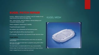 Evolution of inguinal hernia repair | PPTX