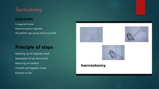 Evolution of inguinal hernia repair | PPTX