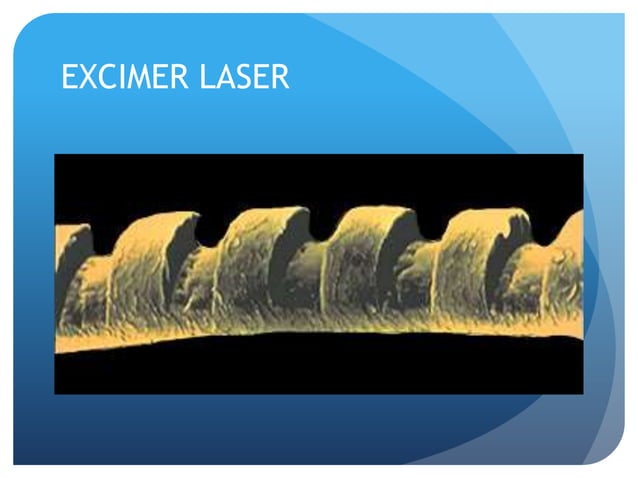 THE EVOLUTION OF LASIK by J. Alberto Martinez MD COPE ID 31538-RS ...