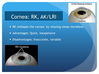 THE EVOLUTION OF LASIK by J. Alberto Martinez MD COPE ID 31538-RS ...