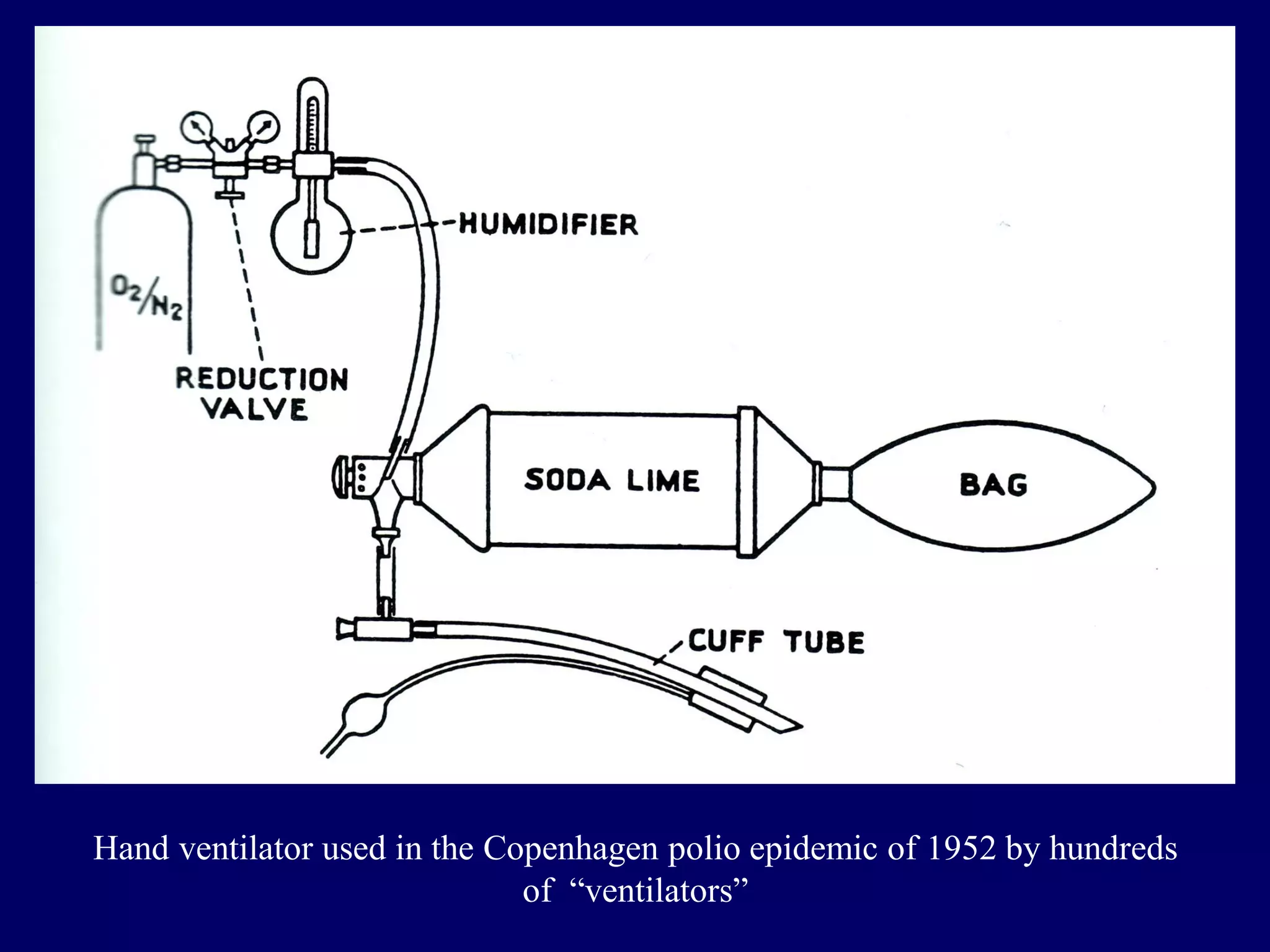 Evolution of mechanical ventilation in the last 20 years | PDF