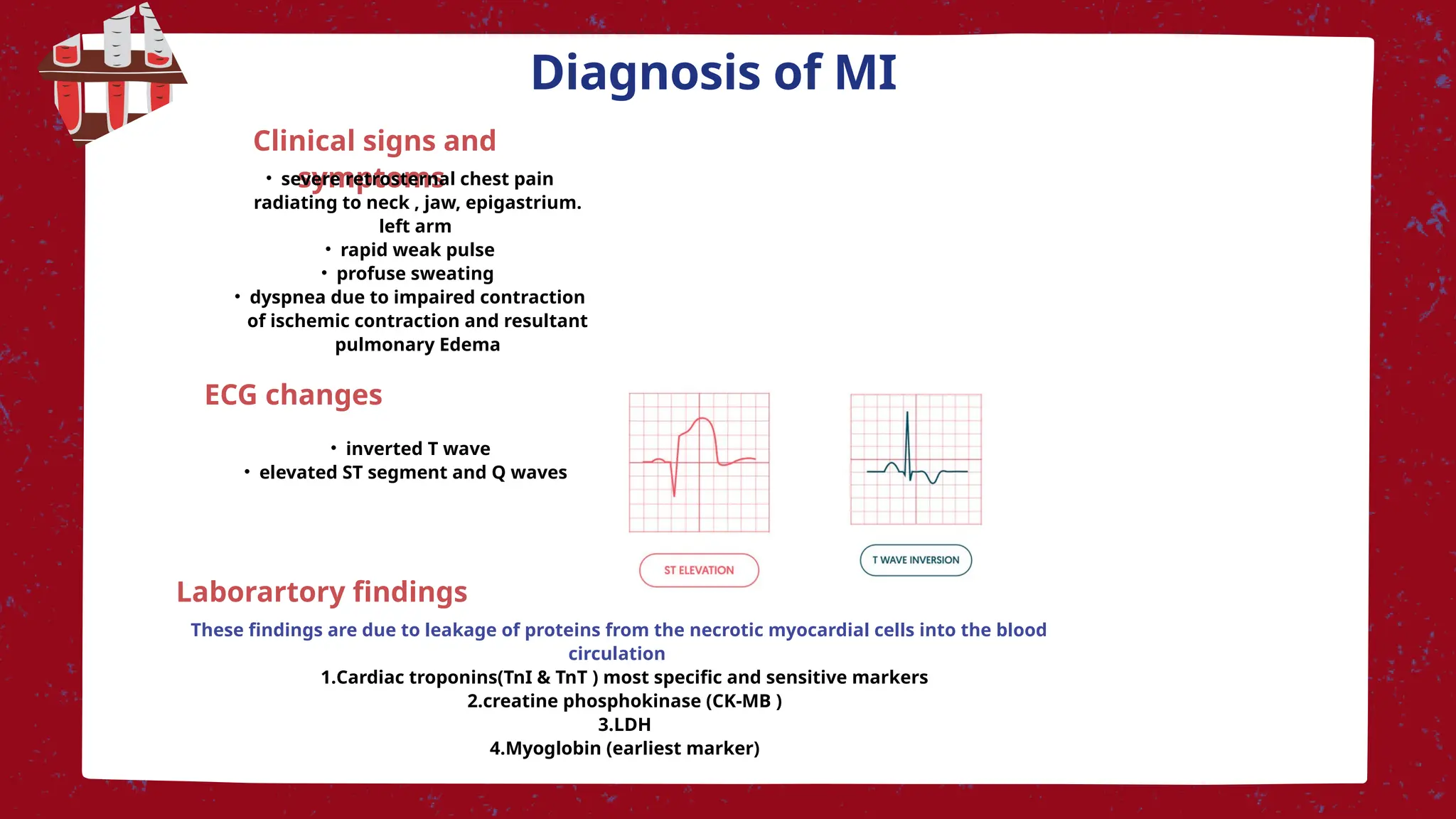 Evolution of morphology of MI cardiac arrest .pptx