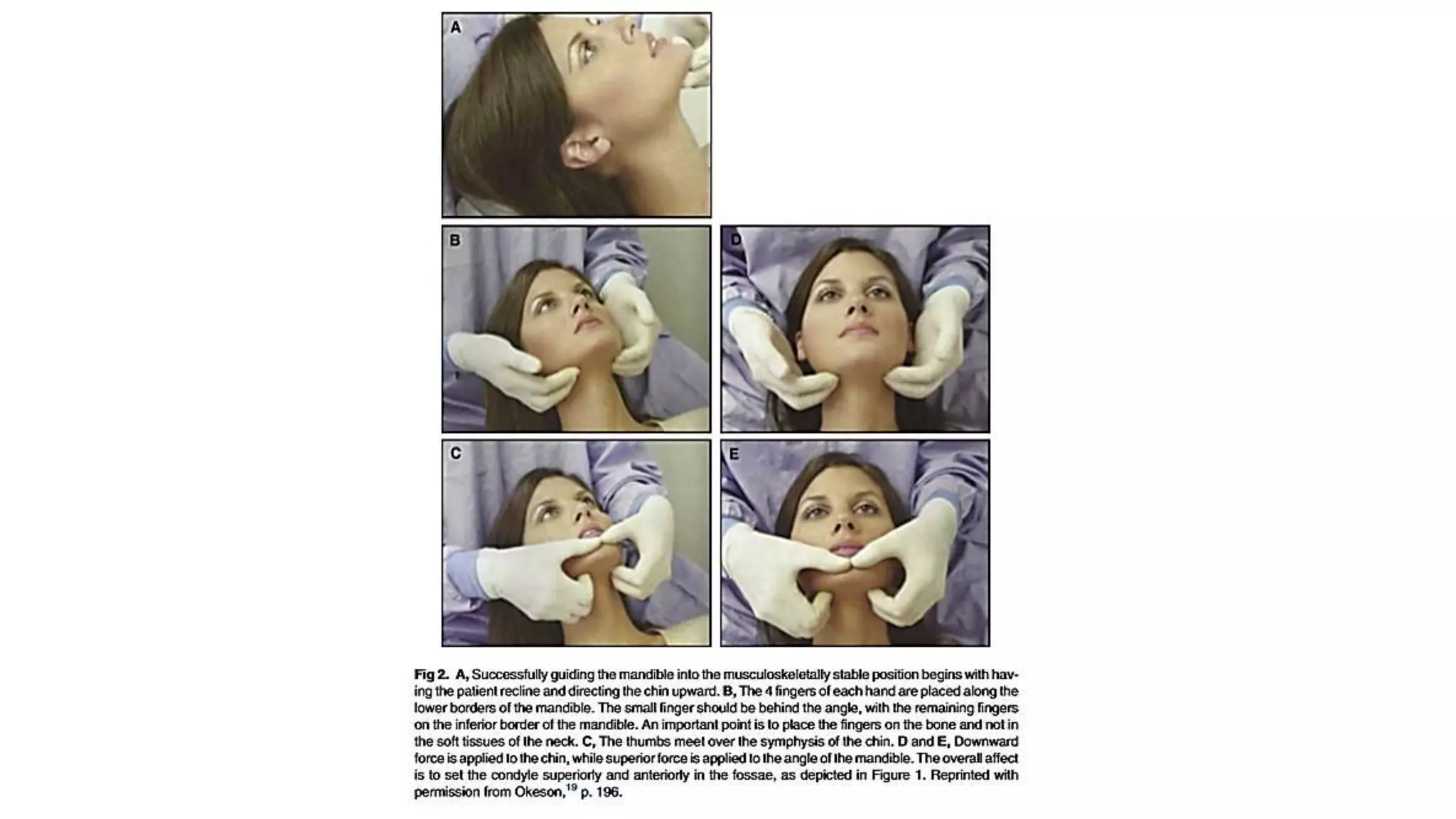 Evolution of occlusion and temporomandibular disorder in orthodontics ...