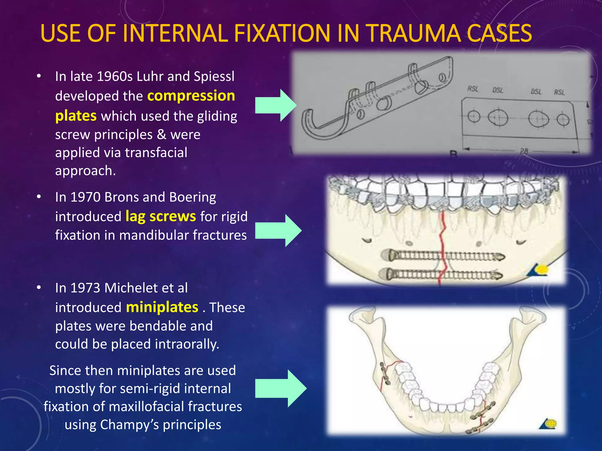 Evolution of oral and maxillofacial surgery | PPTX