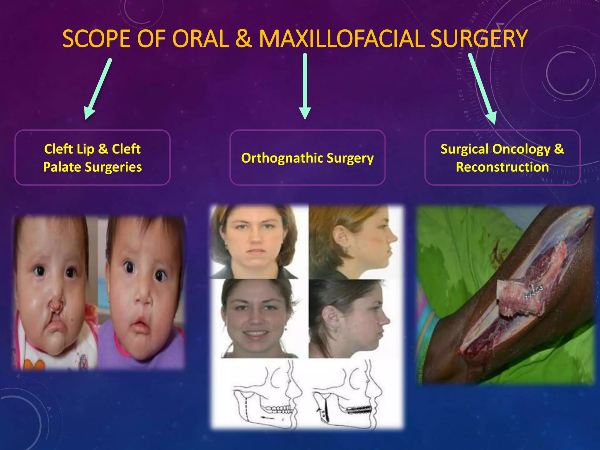 Evolution of oral and maxillofacial surgery | PPTX