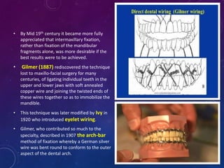 Evolution of oral and maxillofacial surgery | PPTX