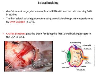 Evolution of retinal detachment surgery | PPTX