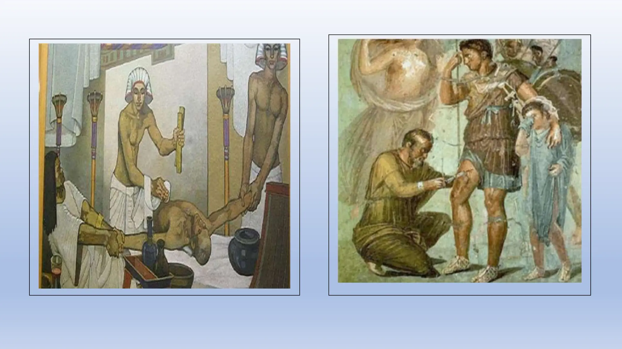 Evolution of Surgery from beginning to today | PPTX