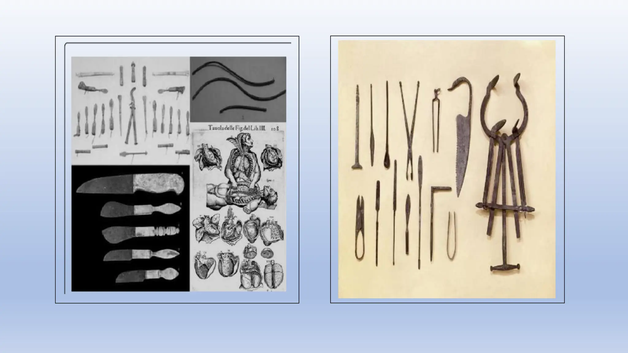 Evolution of Surgery from beginning to today | PPTX