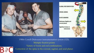 Evolution of surgical strategies instrumentation in scoliosis- dr ...