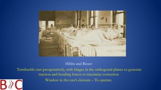 Evolution of surgical strategies instrumentation in scoliosis- dr ...