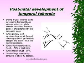 Evolution of tmj and its development | PPT