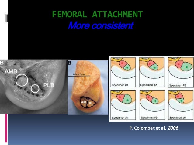 Evolution of tunnel placement in ACL reconstruction
